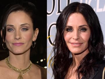 Vorher & Nachher: Diese Stars hatten Botox-Behandlungen