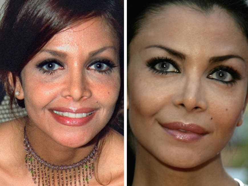 Schönheitswahn - Die Stars früher & heute | GRAZIA Deutschland