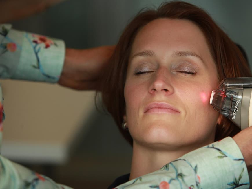Fraxel: Schönheitschirurg klärt auf: So effektiv ist die fraktionierte Lasertherapie gegen ...