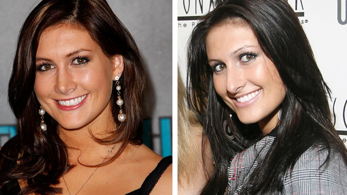 Vorher & Nachher: Diese Stars hatten Schönheits-OPs