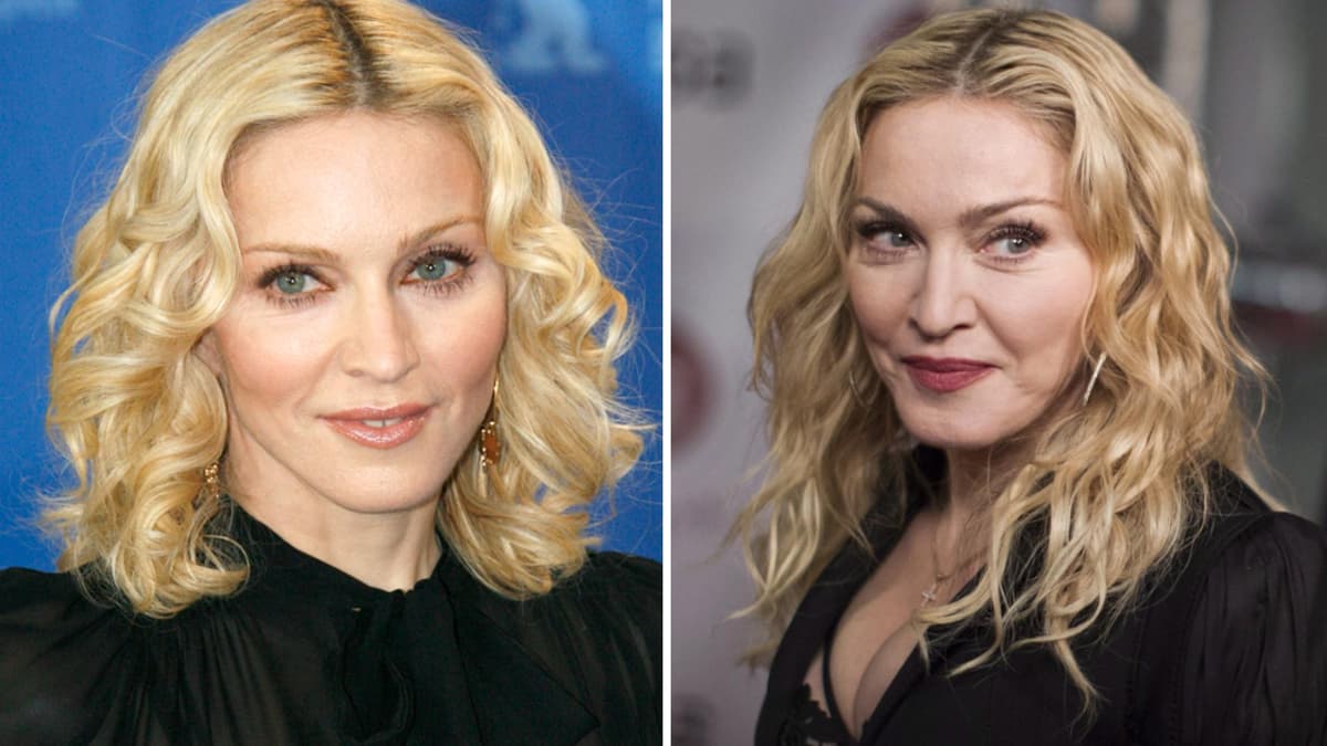Verwunderlich Schonheits Ops Stars Vorher Nachher Bilder